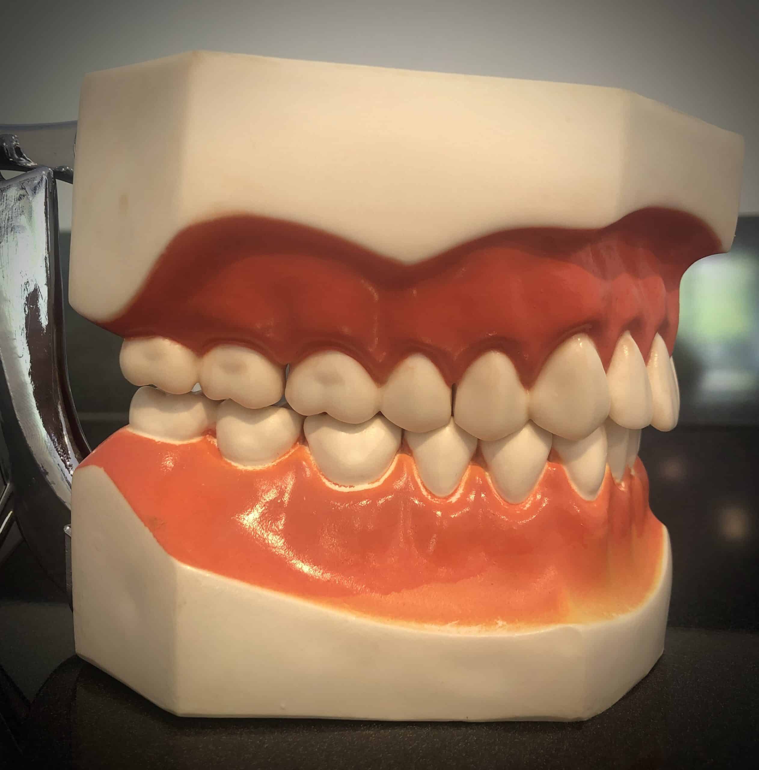 Frequently Asked Questions – Alexandra Hills Dental